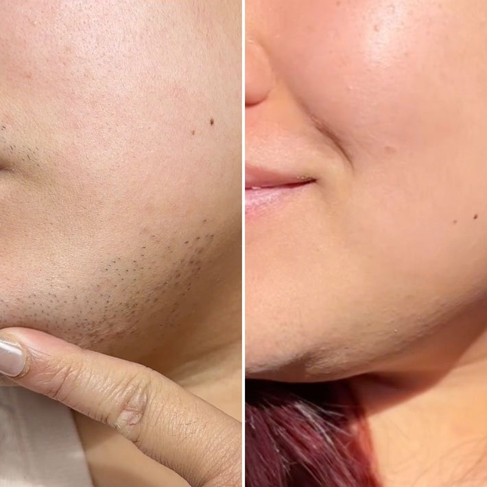 Diamond IPL Pro – Diamond Skin Pro