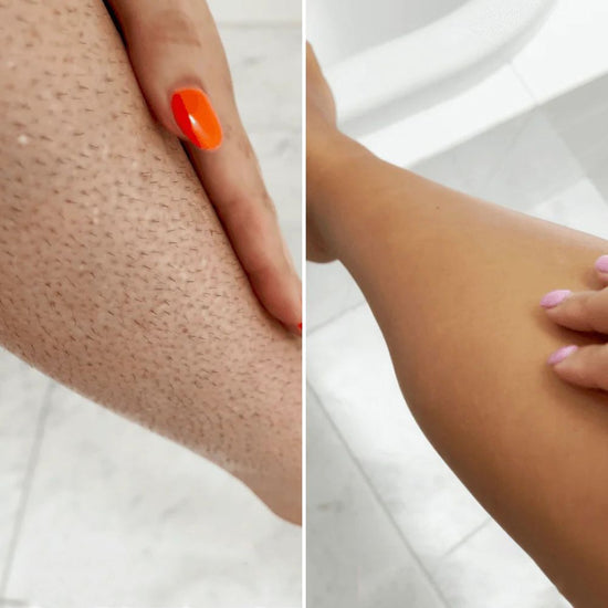 Diamond Hair Eraser, Crystal Hair Remover, Best Crystal Hair Removal ...